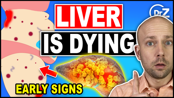 7 Unusual Signs That You Have Liver Damage - Doctor Explains - NuVision ...