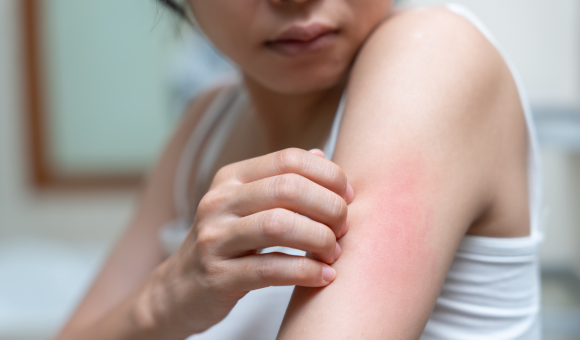 Decoding Your Skin: 12 Things Your Skin Says About Your Health ...